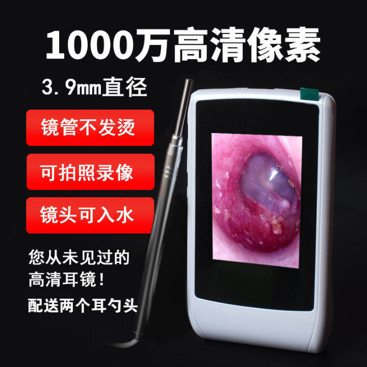 Visual Ear Picking Otoscope 10 Million HD 3-Inch Ear Picking Tool ...