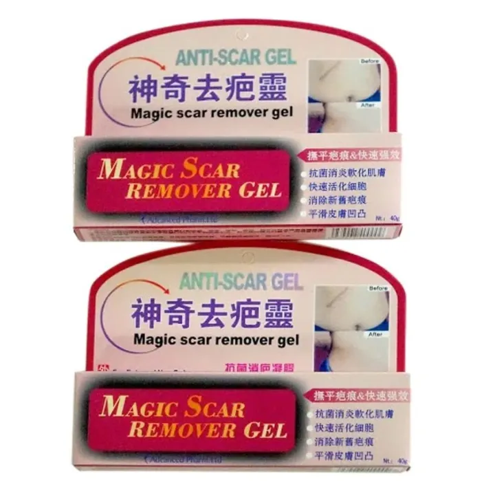 Magic Scar Remover Gel 40g Set of 2 | Lazada PH